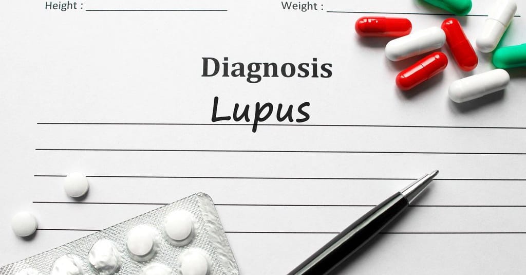 Lupus, Penyakit Autoimun, Apa Penyebab dan Gejalanya?