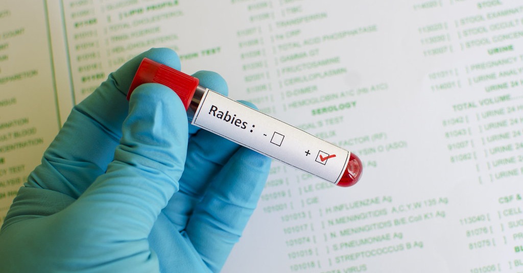 Apa Itu Hydrophobia Rabies, 6 Gejala, Kenapa Rabies Takut Angin?