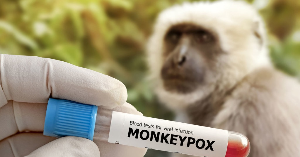 Cacar Monyet di Indonesia, Cara Pencegahan & Soal Vaksin Monkeypox