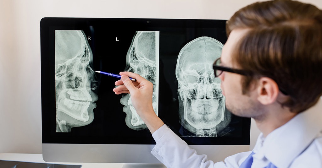 Bagian-bagian Hidung dan Fungsinya pada Pernapasan Manusia