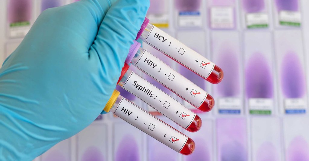 Mengenal Apa Saja Gejala Gonore pada Pria, Perempuan & Sebabnya?