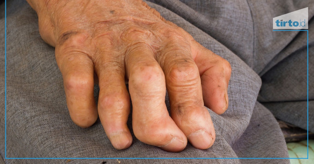 Apa Itu Penyakit Kusta: Penyebab, Gejala, dan Ciri-Cirinya