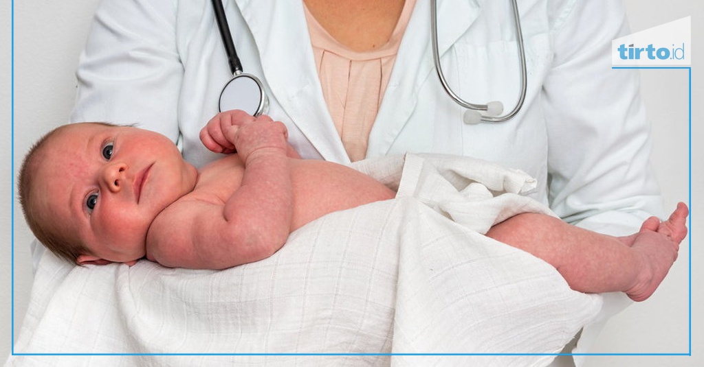 Mengenal Gejala Trisomy 18 atau Edward Syndrome