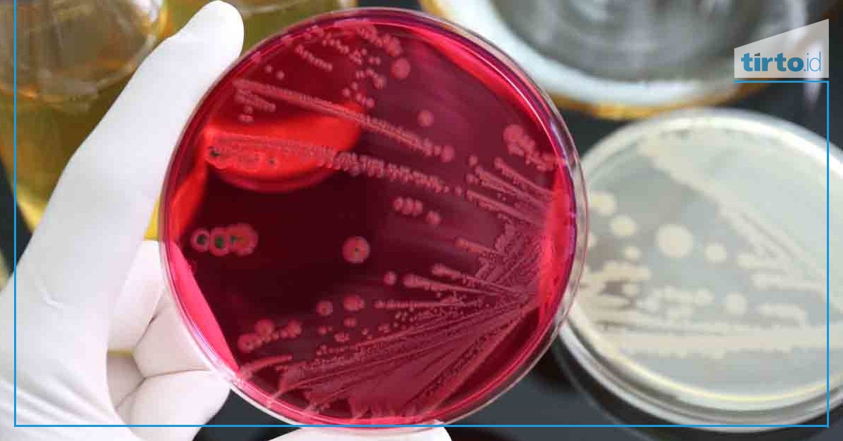 Apa Itu Bakteri Salmonella dan Risiko Penyakit yang Ditimbulkannya?