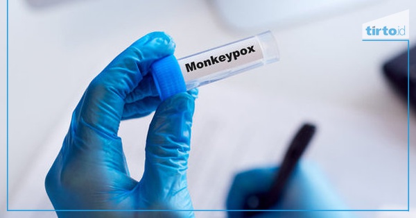 Asal-usul Cacar Monyet serta Cara Penularan Monkeypox dan Gejalanya