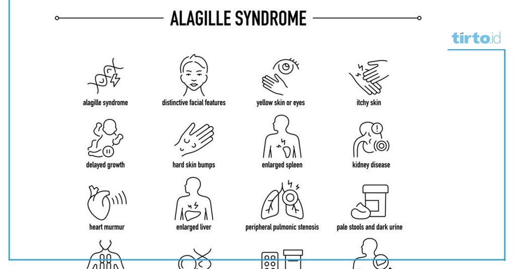 Sindrom Alagille pada Bayi: 11 Gejala, Efek dan Penyebabnya
