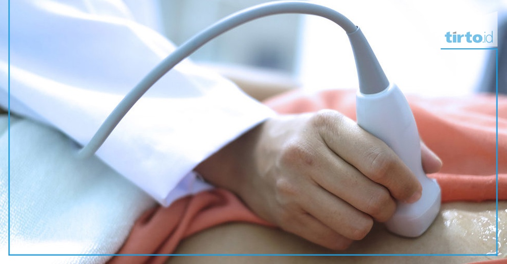 USG Trimester 3 Berapa Kali dan Apa Saja yang Perlu Ditanyakan?