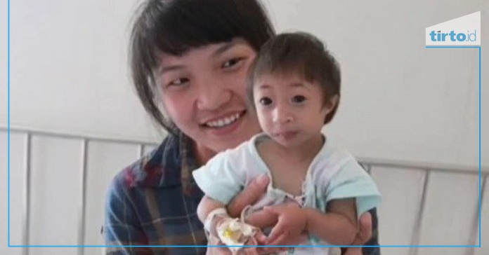 Siapa Xiao Xiao yang Viral di TikTok karena Disebut Mirip Dobby?