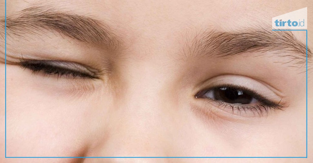 8 Makna Kedutan Mata Kanan Atas dari Segi Medis dan Mitos
