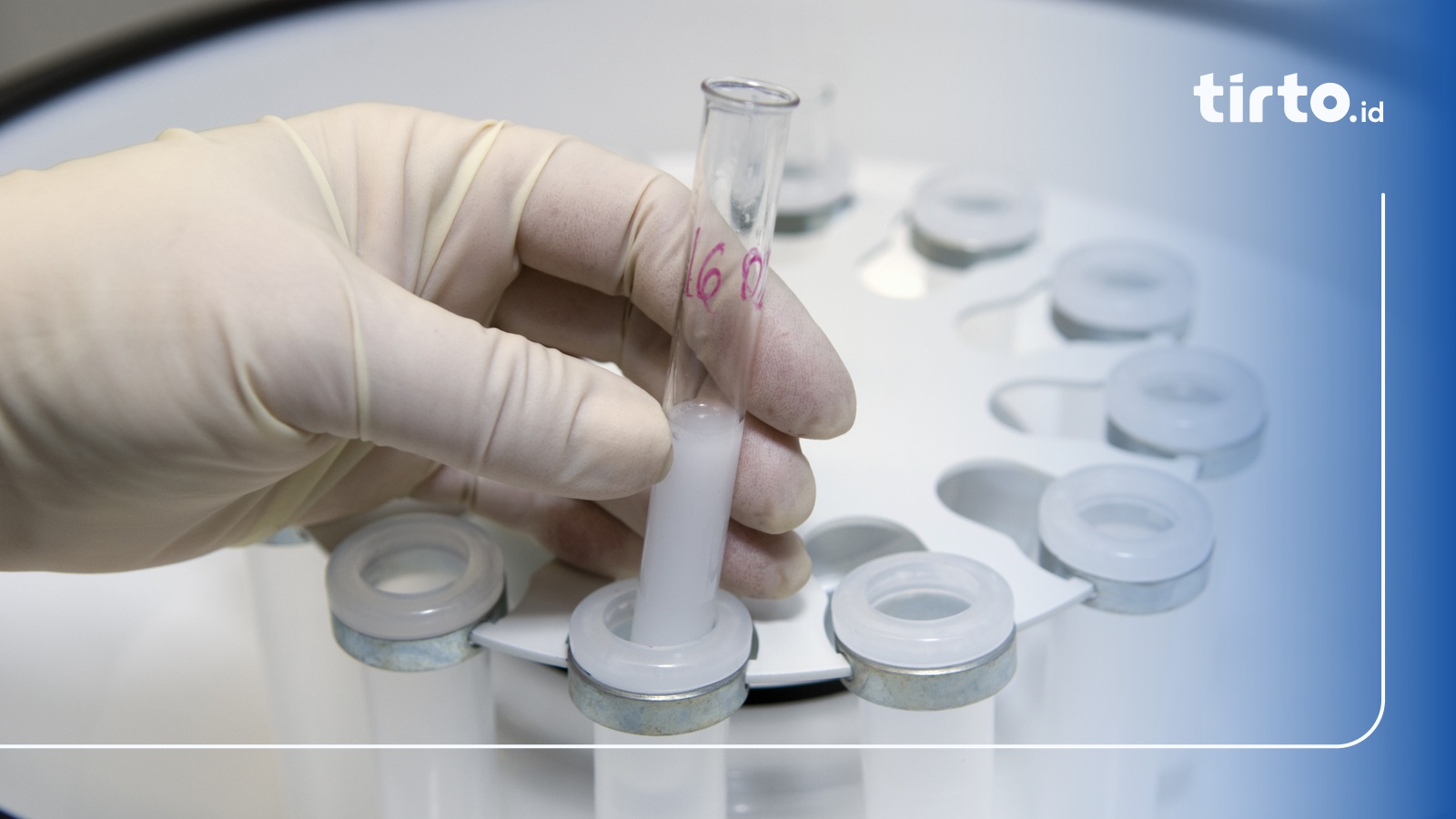 Berapa Biaya Program Bayi Tabung Berdasarkan Tahapan IVF?