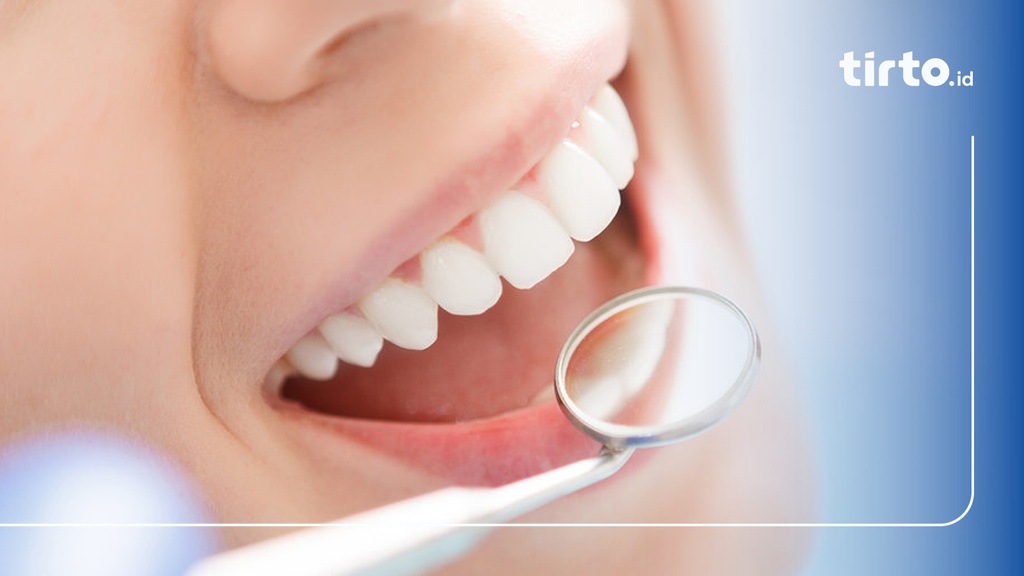 Mengenal Bonding Gigi: Manfaat, Risiko dan Cara Merawatnya