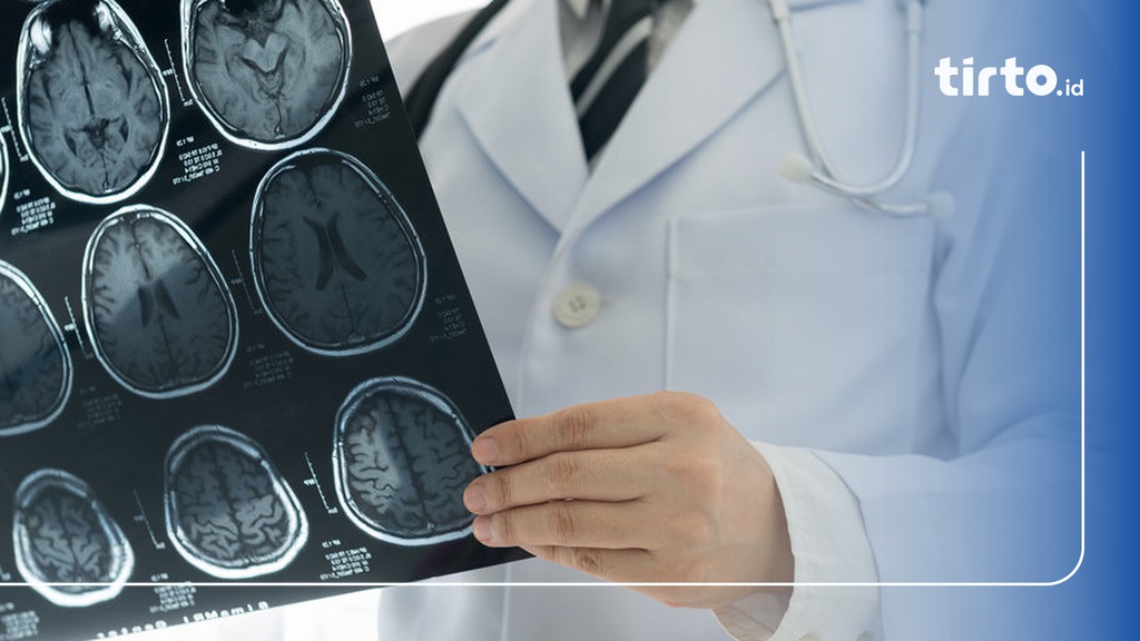 Mengenal Tanda dan Gejala Stroke pada Wajah Serta Penyebabnya
