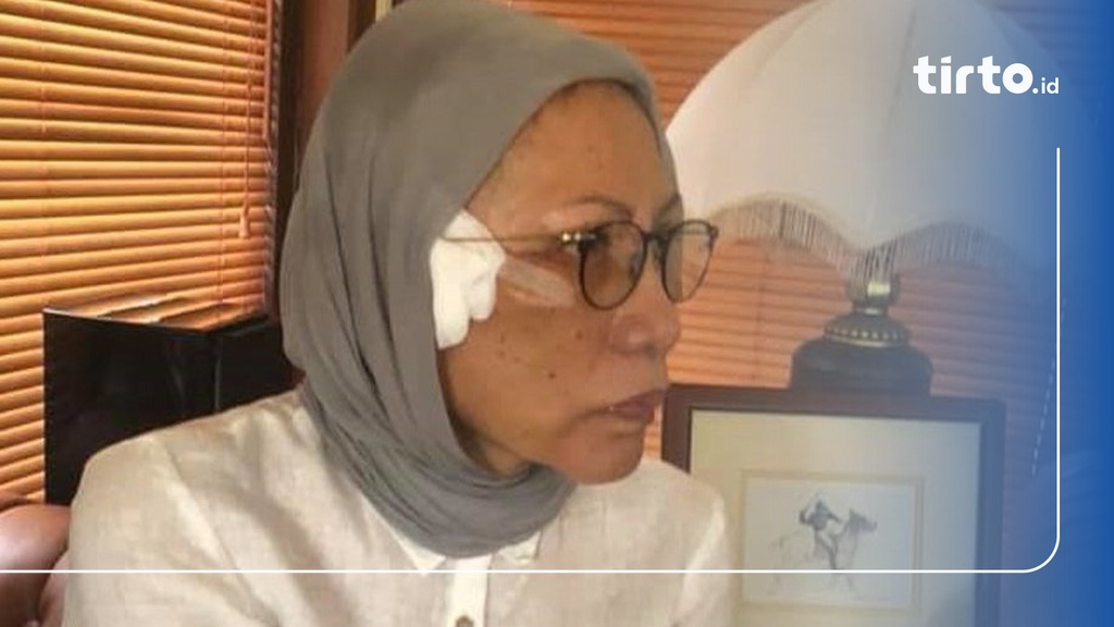 Ratna Sarumpaet Lebam Setelah Operasi Plastik, Kenali Penyebabnya