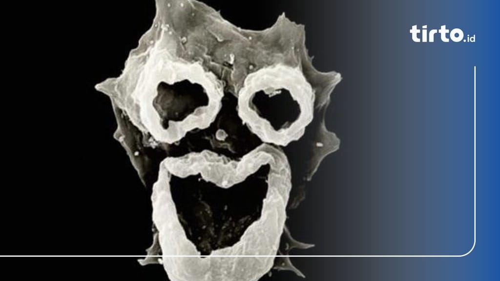 Penyebab Infeksi Amoeba Pemakan Otak di Korea, Bisakah Sembuh?