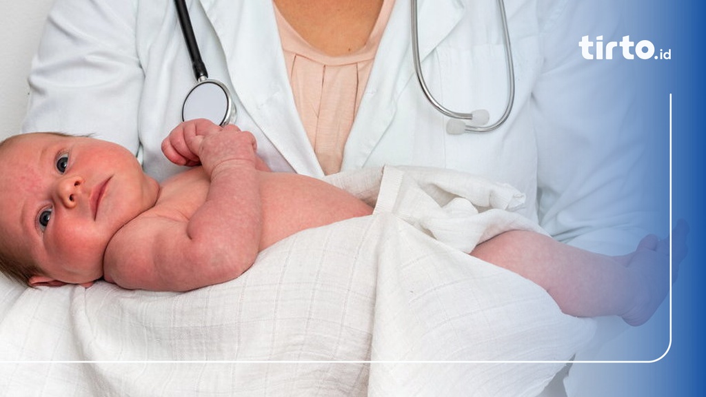 Mengenal Gejala Trisomy 18 atau Edward Syndrome