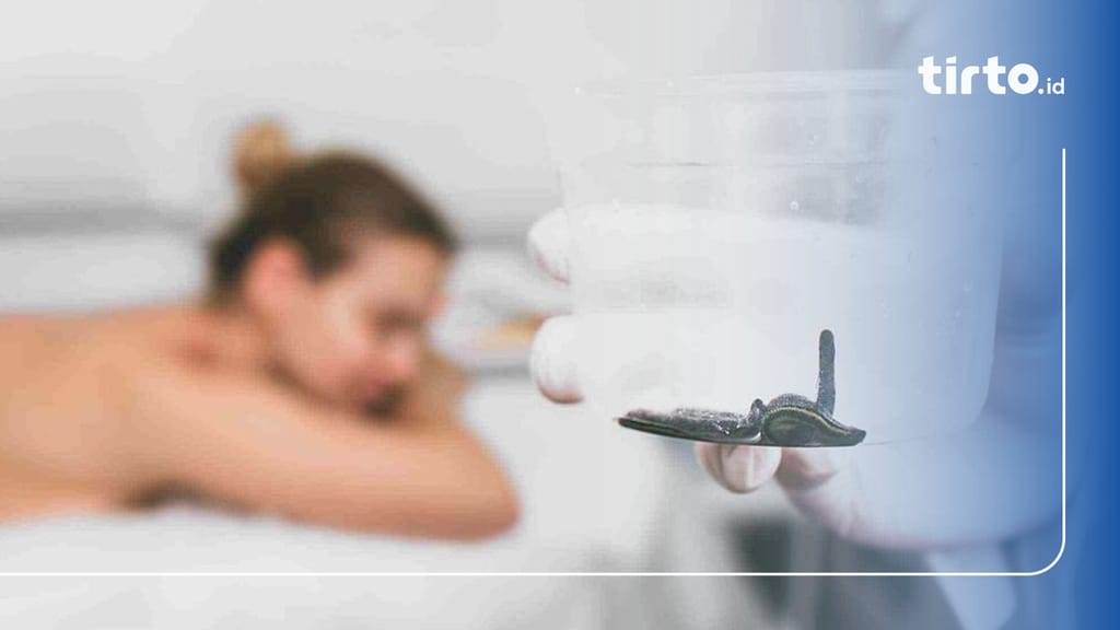 Cara Kerja Terapi Lintah, Manfaat, & untuk Penyakit Apa Saja?