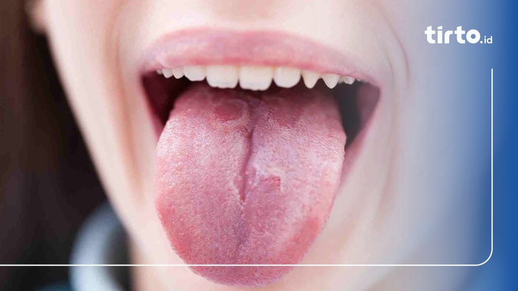 Ciri-Ciri Lidah Sehat dan Cara Menjaga Kesehatannya