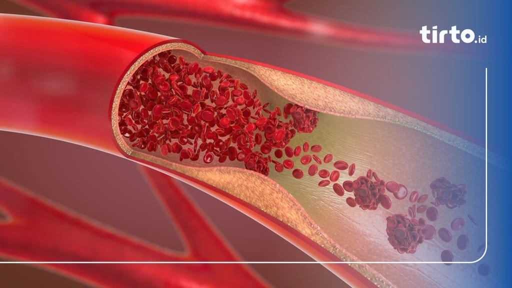 Mengenal Sel Darah dan Fungsinya: Eritrosit, Leukosit, Trombosit
