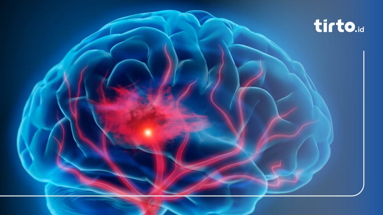Mengenal Penyakit Atrofi Otak, Penyebab, dan Cara Mengatasinya