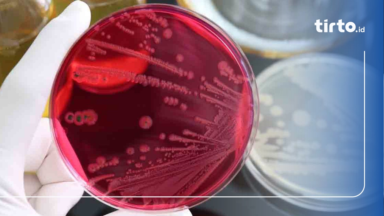 Apa Itu Bakteri Salmonella dan Risiko Penyakit yang Ditimbulkannya?