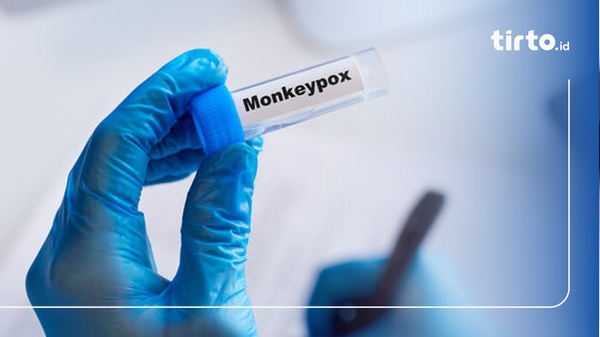 Asal-usul Cacar Monyet serta Cara Penularan Monkeypox dan Gejalanya