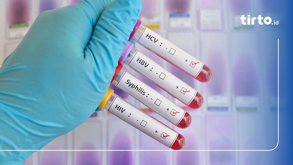 Info Tes HIV dan Layanan ARV Semarang Malam Hari Februari 2023