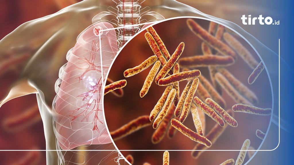Hari Tuberkulosis Sedunia 2023: Negara dengan Kasus TB Tertinggi