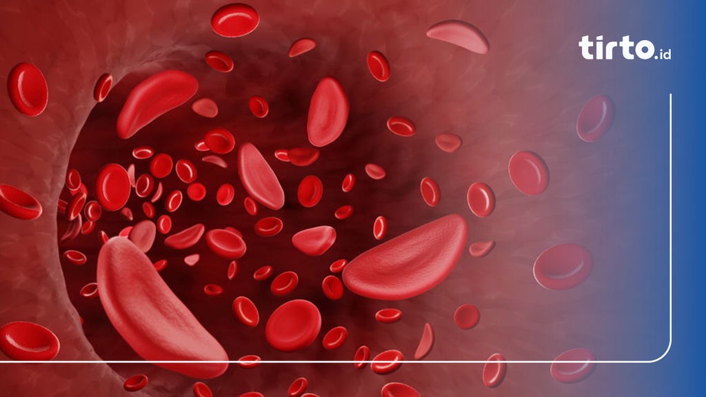 Kenali Penyakit Anemia Sel Sabit, Bisa Berlangsung Seumur Hidup?