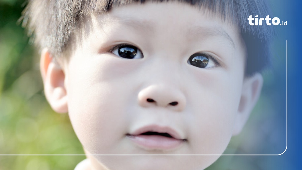 Mengenal Apa Itu Stickler Syndrome, Penyebab & Gejala Lengkapnya