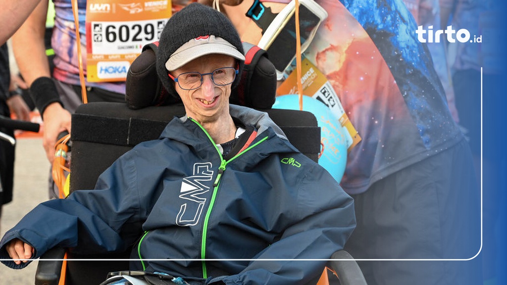 Profil Sammy Basso Survivor Progeria Tertua & Penyebab Meninggal